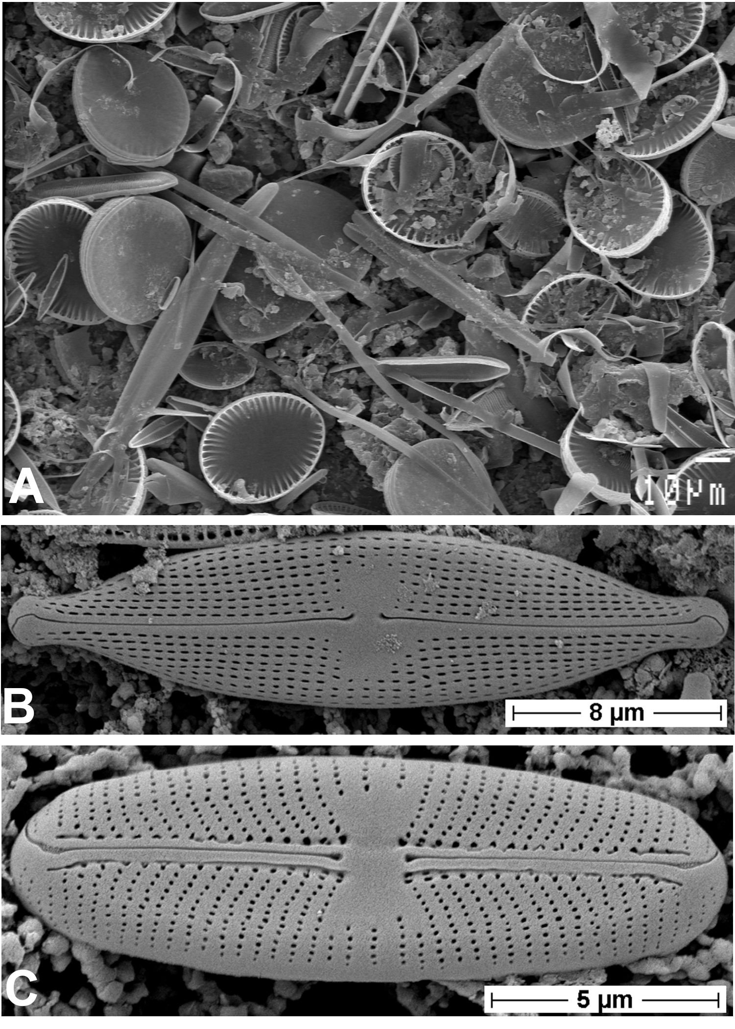 Diatoms Help Catch Criminals Science In Poland